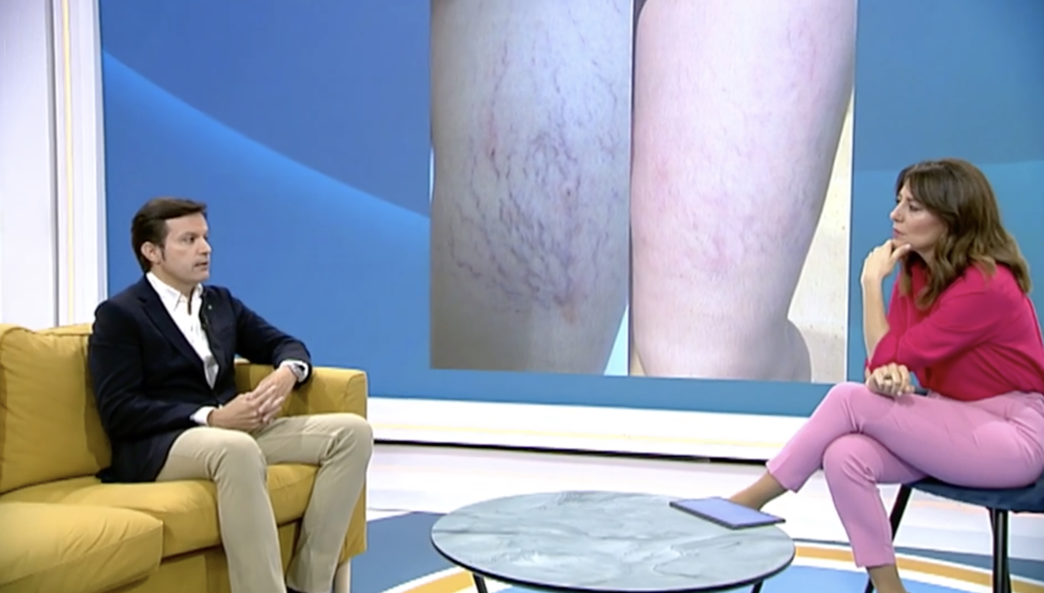 Varices: causas y tratamientos. Hablamos con el cirujano vascular Ángel ...